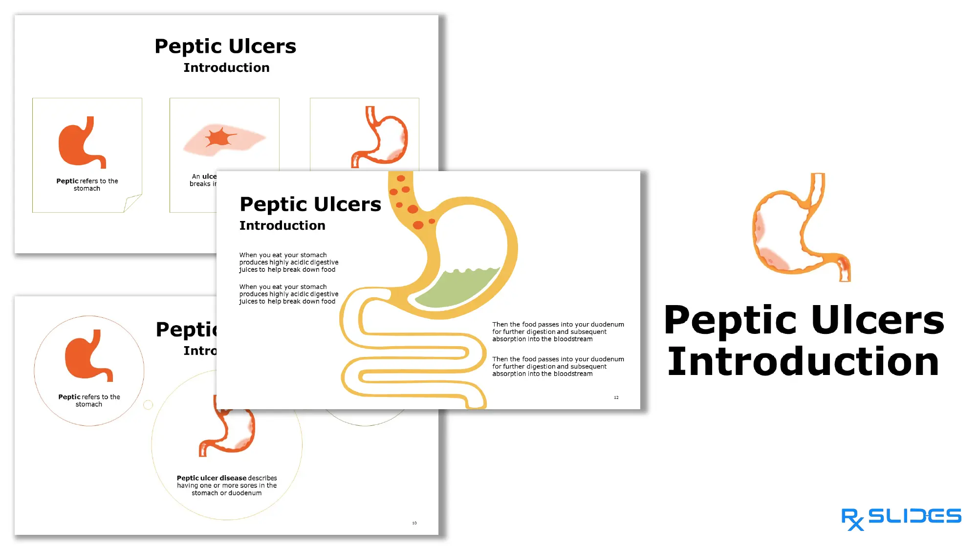 Download Peptic Ulcer Disease PowerPoint Template| RxSlides